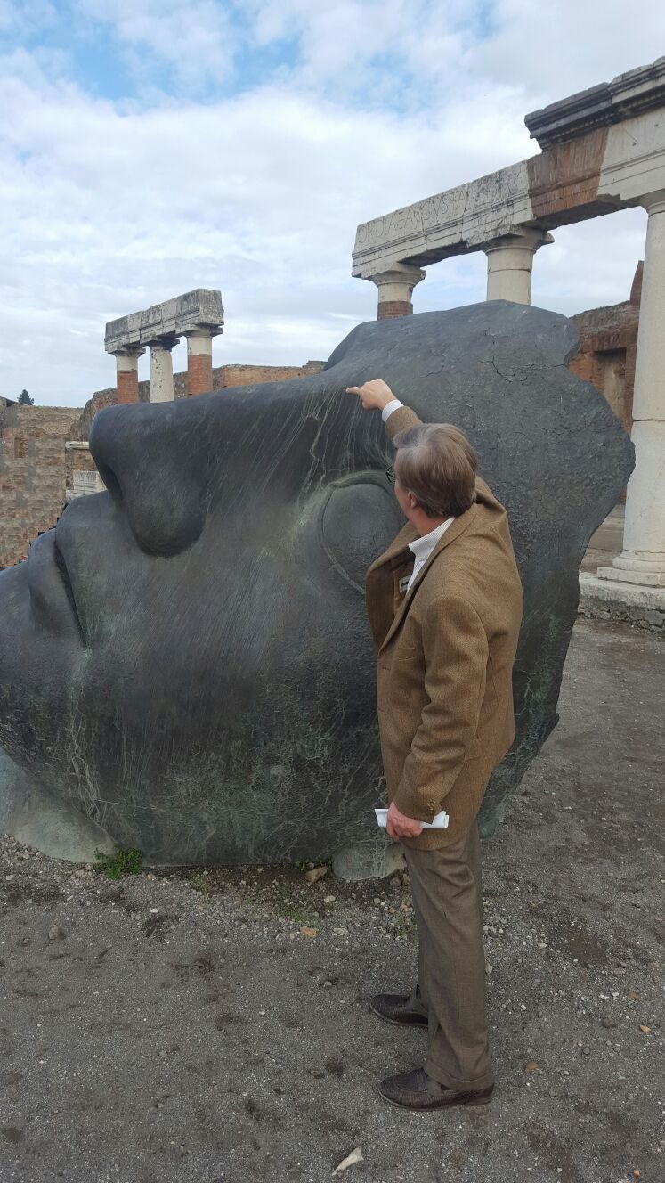 RINOPLASTICA : LA CORREZIONE DEL NASO GRECO